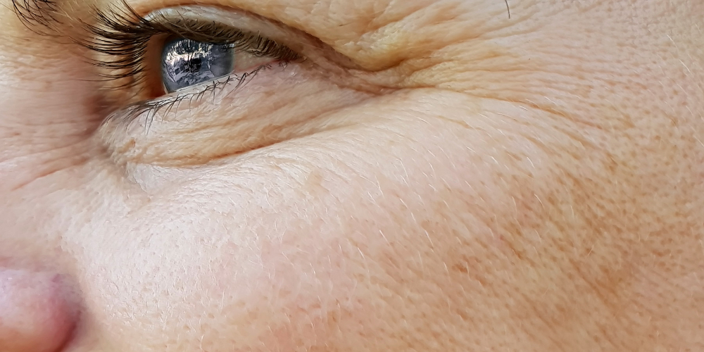 Wrinkles Tips You Need To Know To Prevent The Appearance